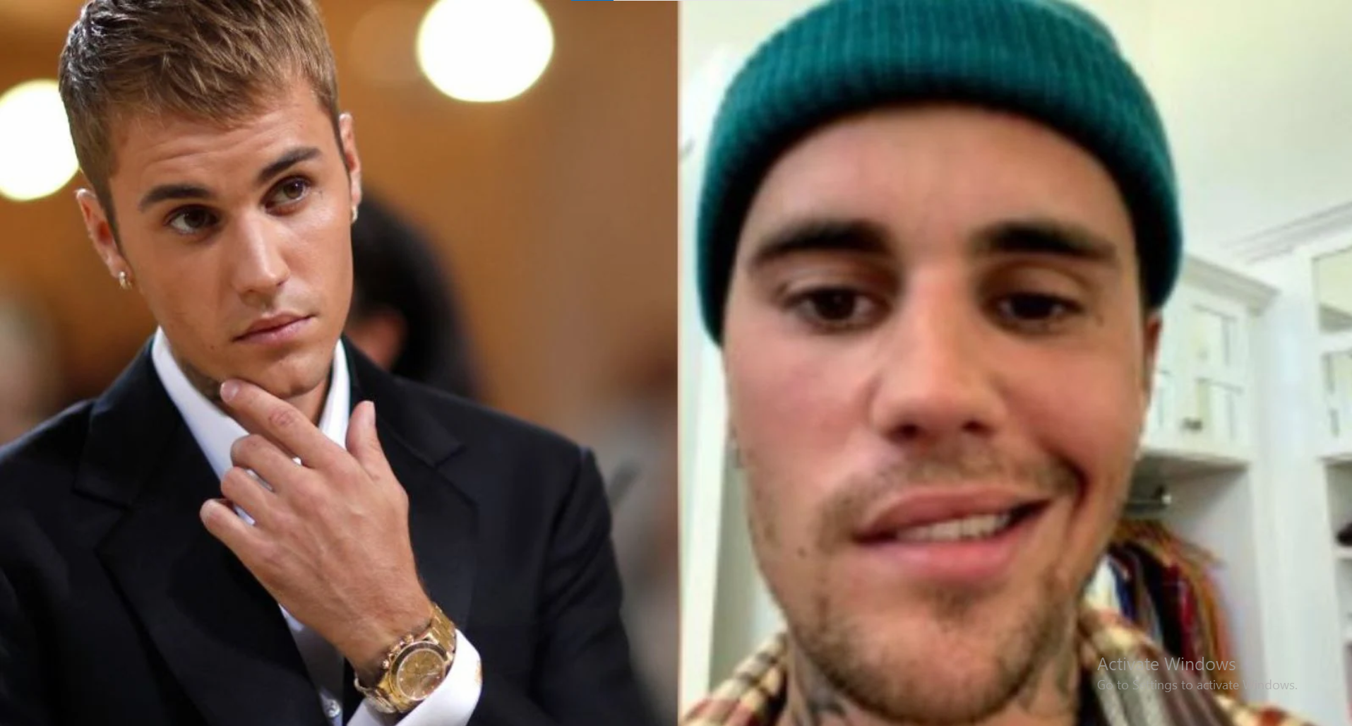 តារាចម្រៀង Justin Bieber មិនអាចកម្រើកមុខបានមួយចំហៀង ...